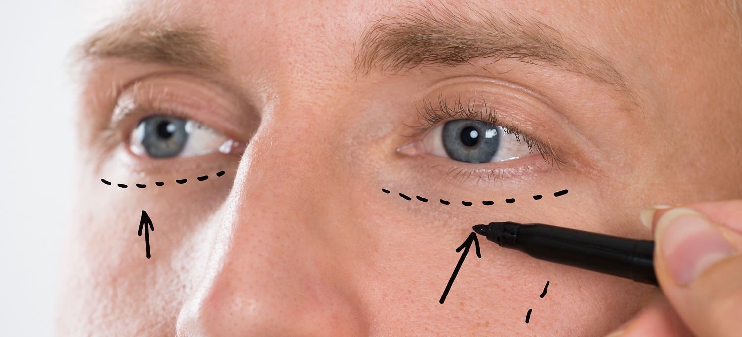 Eyelid Surgery for Men - Upper and Lower | Enhance Your Gaze